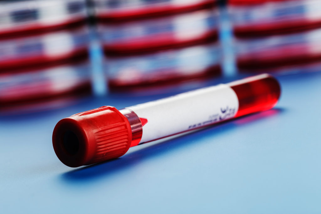 A National Immunisation Strategy to 2030 - RESEARCH AUSTRALIA